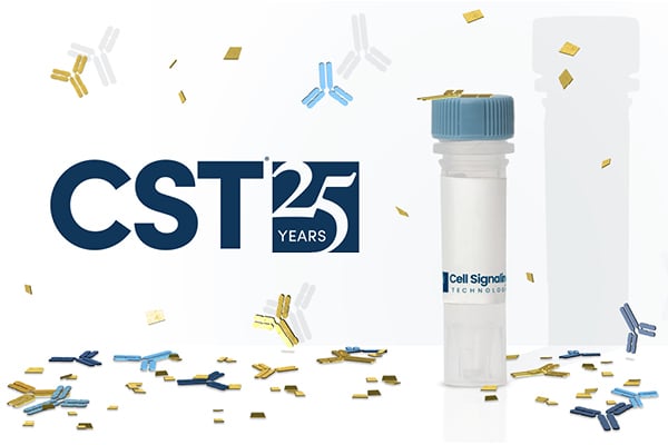 CST 25周年キャンペーン第二弾